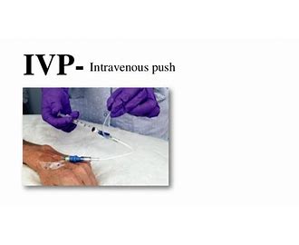 What does IVPB stand for?