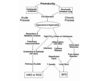 مخفف کلمه RDS چیست؟